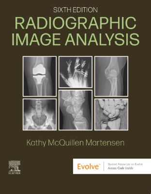 Radiographic Image Analysis - Heimkaup.is